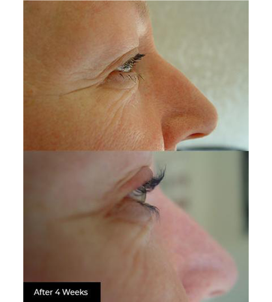 Avante Dynamic Lash Serum 2ml – Avante Cosmetics