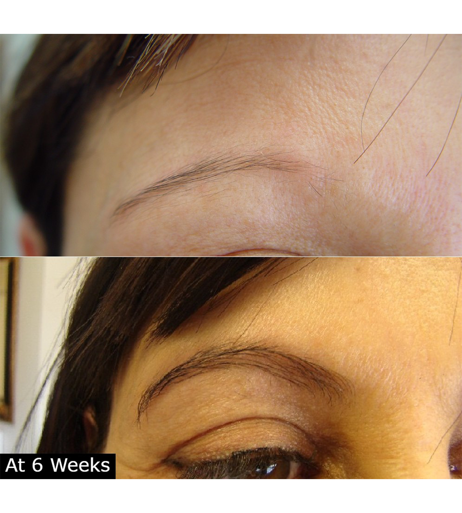 Avante Dynamic Brow Serum 4ml – Avante Cosmetics